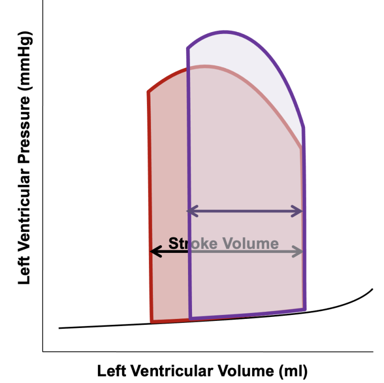 Pressure Volume Loops Basic Human Physiology